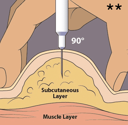 Subcutaneous Injection Guide - Basics and Best Practices